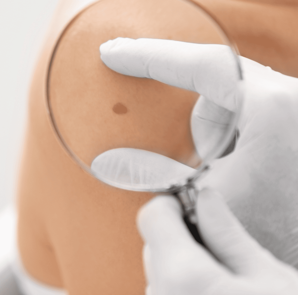 Shedding Light on National Cancer Prevention Month: Protecting Your ...